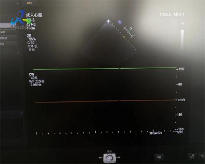 China Imagem de manutenção do transdutor da sonda de ultrassom GE S8-3 com erro à venda