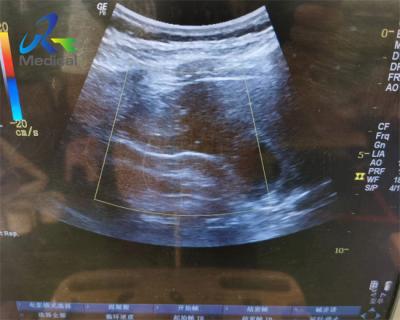Cina Lente di manutenzione del trasduttore di riparazione della sonda a ultrasuoni GE 4C in vendita
