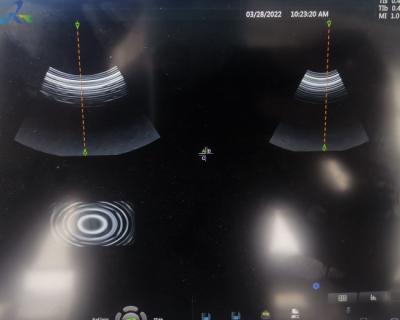 中国 GE RAB6-D 4Dの超音波のトランスデューサー修理心血管の超音波機械 販売のため