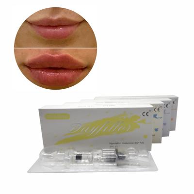China Deep Hyaluronic Acid Dermal Filler Cross Linked Ce Butt Face Facial for sale