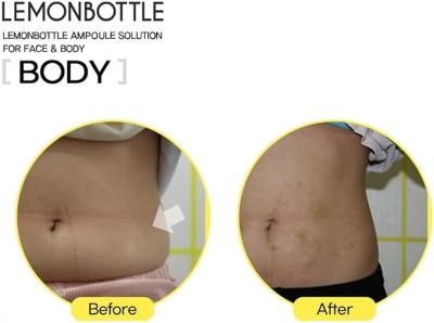 Cina Lemon Bottle Solution Lipolysis weight loss 10ml X 5 fat loss lemonbottle in vendita
