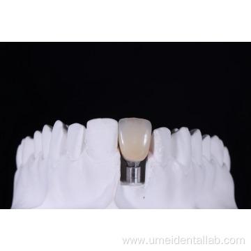 China Custom Abutment Implant Crown for sale