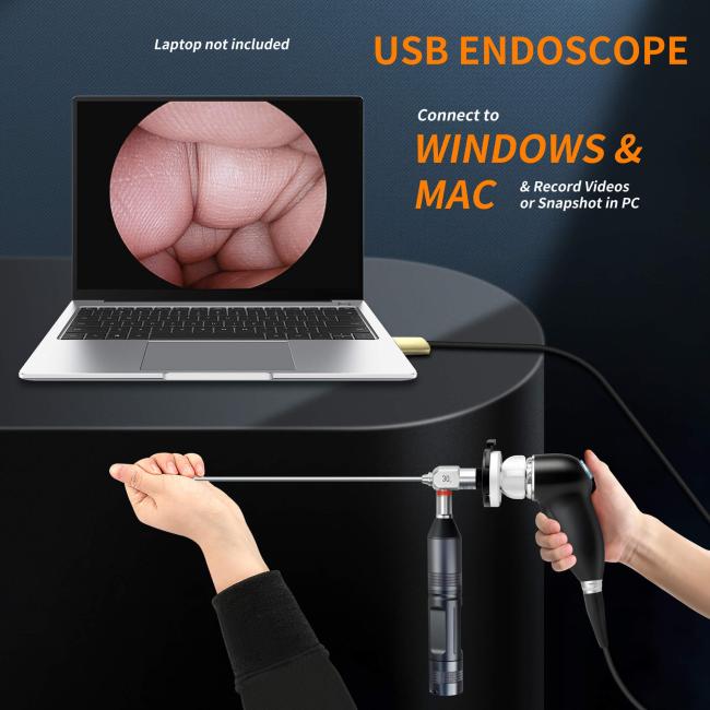 Close-up of the USB endoscope camera handle and SONY CMOS sensor head used for ENT and veterinary examinations
