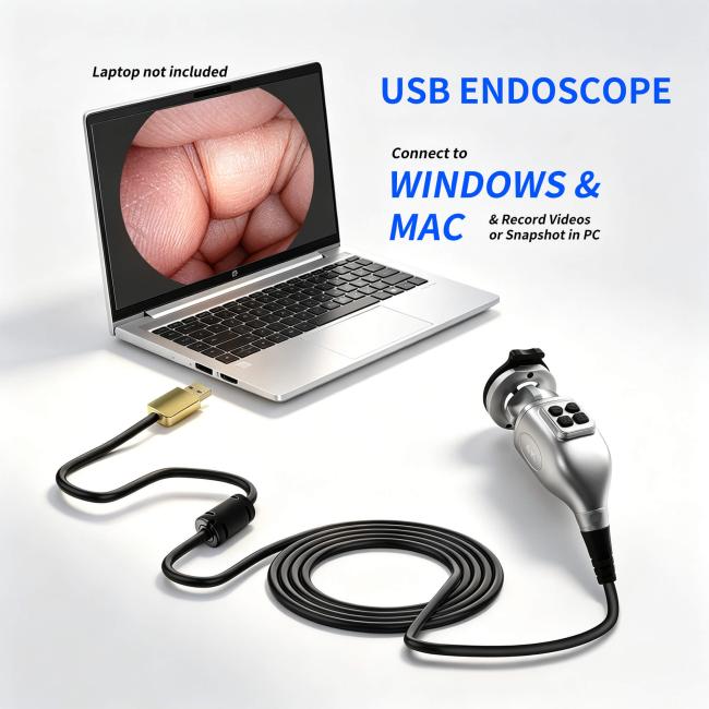 Industry-first 4K USB medical endoscopic camera with ergonomic camera head and USB 3.0 connectivity