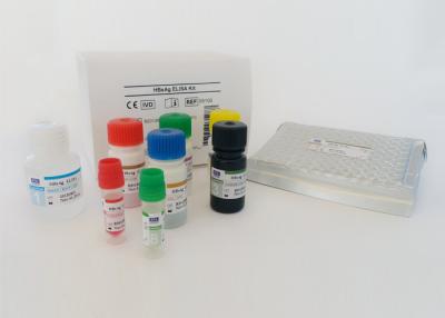 Cina Immunotest enzimatico del panino di Elisa del corredo della prova di HBsAg del certificato di GMP per l'essere umano in vendita