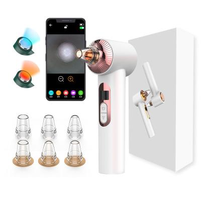 China Vacuum Suction Visible Skin Care Blackhead Remover 53Kpa for sale