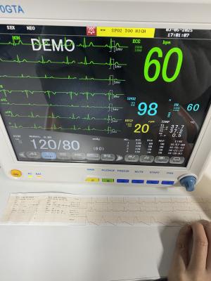 Chine Moniteur patient multiparamétrique portable avec écran 12,1 pouces et chariot/support mural pour USI à vendre