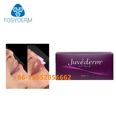 Chine Injection cutanée d'acide hyaluronique de Juvederm 2ml de remplisseur d'amélioration de lèvre à vendre