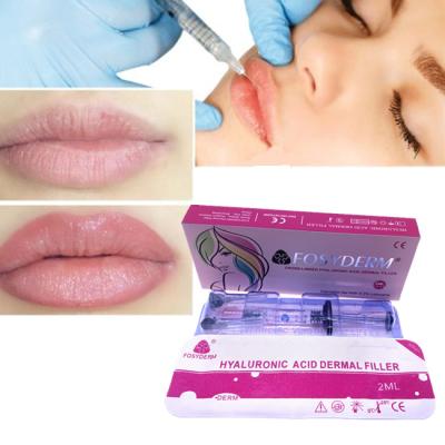 Chine Remplisseur de lèvres Élargissement de la plénitude des lèvres 2 ml Remplisseur cutané Fosyderm HA Remplisseur d'injection à vendre