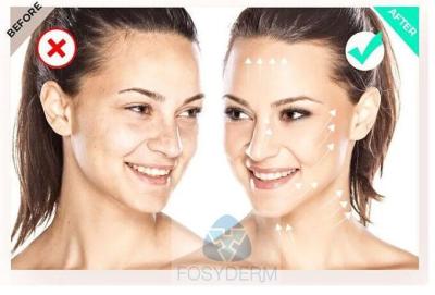 Chine Filorga  135ha 5*3ml Mesothérapie par injection faciale pour améliorer la qualité de la peau à vendre