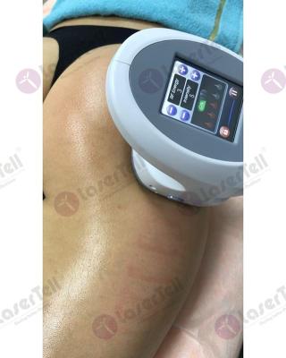 Κίνα Κενός εξοπλισμός μασάζ κυλίνδρων Cellulite 100kPa αδυνατίσματος σώματος αντι προς πώληση