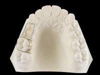 Quality Flexible Band And Loop Space Maintainer Adjustable Orthodontic Functional Appliance for sale