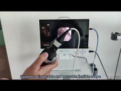 Système de caméra d‘endoscopie tout-en-un TU-15LSD1C avec imagerie Full HD pour les ORL et la laparoscopie