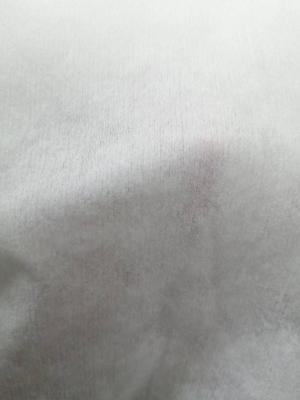 High-Efficiency Breathable Spunlace Nonwoven for Sanitary Protection and Daily Care