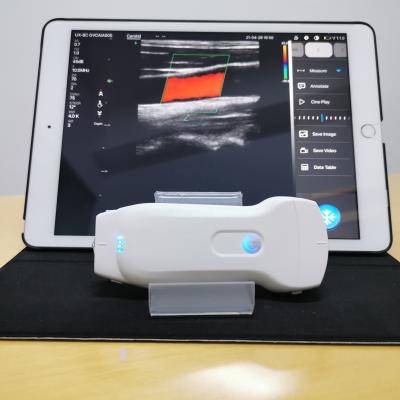 China MSL Highest Cost-effective Double Probes Wireless Color Doppler Ultrasound Scanner for sale