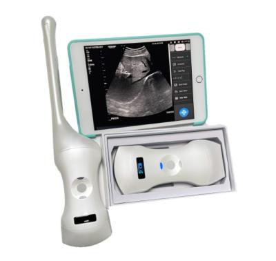 China 3 in 1 Wireless Convex Phased Array Linear Transvaginal Array Color Doppler Ultrasound Scanner for sale