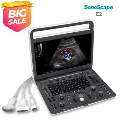 China Sonoscape E2V E2 Veterinary Scanner Portable Color Doppler Ultrasound Machine for sale