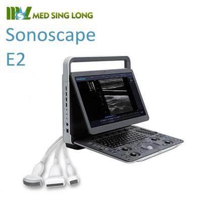 China SonoScape E2pro Color Doppler Echo Machine Ultrasound Machine USG with TDI CW PW Function for sale