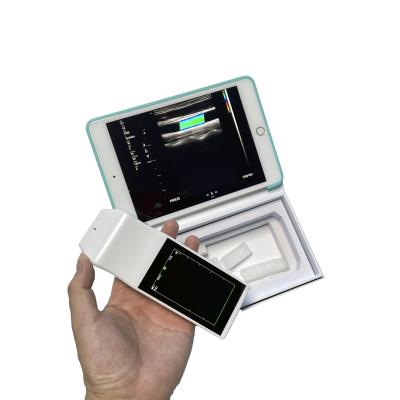China Wireless Linear Probe High Frequency Probe Special Tool for Visual Puncture Guidance Integrated Handheld Ultrasound Scanner for sale