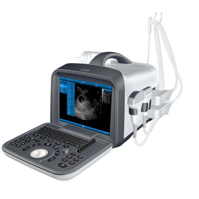 China 2021 Top Selling Medical Ultrasound Instruments, Portable B&w Ultrasound Scan Machine for Hospital for sale