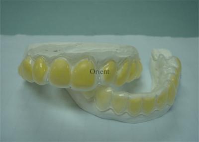 Κίνα Οι Orthodontic συσκευές FDA είναι αντιδιαβρωτικές και ανθεκτικές προς πώληση