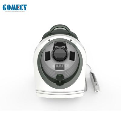 Cina 4GB Ram Facial Scanner Skin Analyzer, macchina di analisi della pelle 3d in vendita