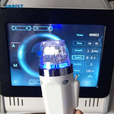 Cina 300W nessuna rimozione frazionaria della cicatrice dell'acne della macchina di Tixel rf di irradiamento in vendita