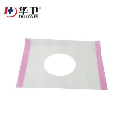 China fenestrated drapes, disposable sterile surgery drape for sale