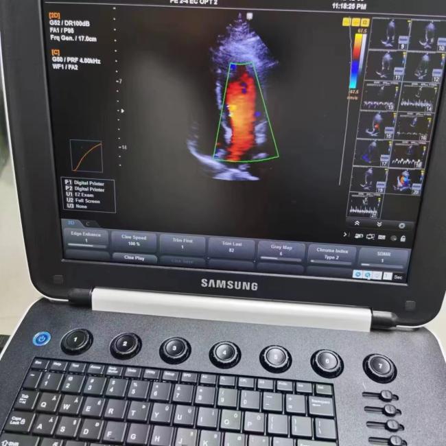 Samsung Medison 4D Ultrasound System HM70A