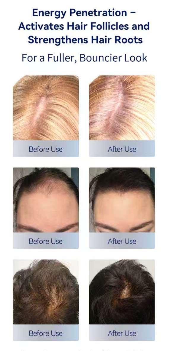 Close-up view of hair growth cap design