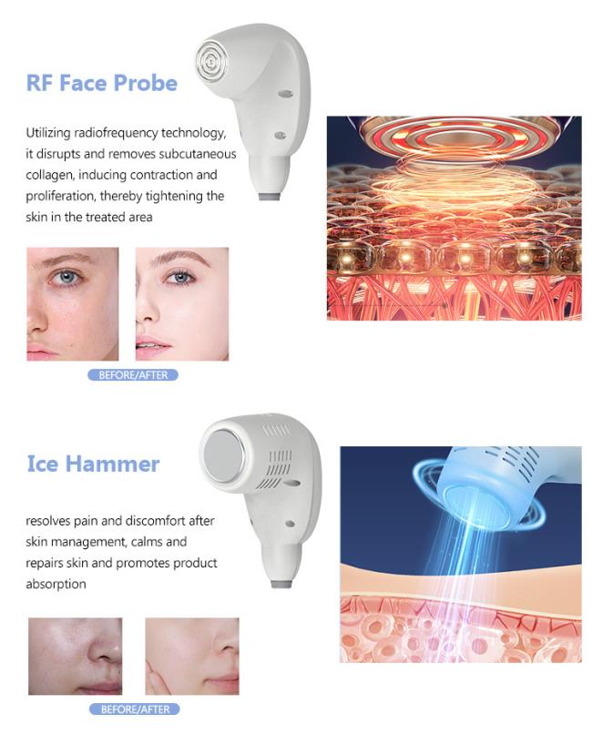 RF microneedling machine display and controls