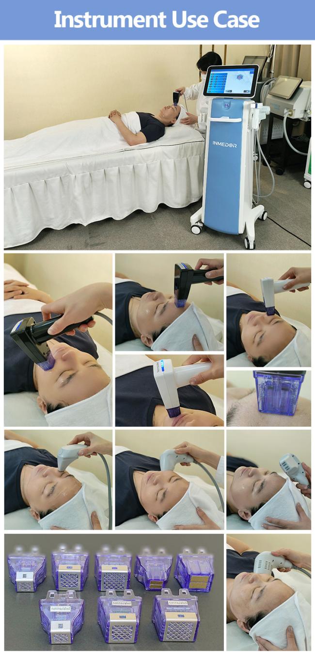Body contouring and fat reduction results