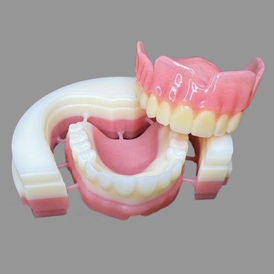 China CAD/CAM Digital Milled Acrylic Base Denture Removable for sale