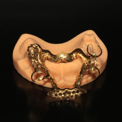 China Anodized 3D Printed Titanium Framework Lightweight For Sensitive Skin for sale