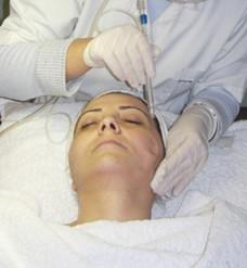Chine Machine faciale de l'oxygène de l'eau de peau de jet, machine d'épluchage de peau d'enlèvement d'acné confortable à vendre
