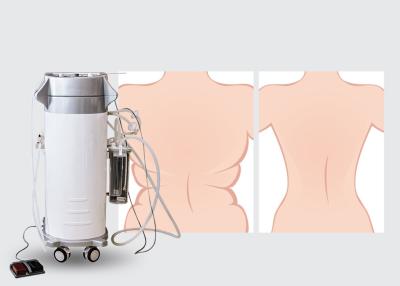 중국 300W 입력 파워 외과 지방 흡입 수술 기계 Lipo 호리호리한 기계 2000ml 수용량 저장 병 판매용