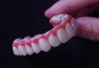 All On X Tandheelkundige implantaten Hybride brug Volle Zirconia Protheses Brug over Tibases