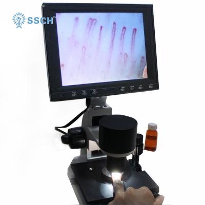 中国 CapillaroscopeのMicrocirculationの顕微鏡の作り付けのカメラ380 000のピクセルGY-3880 販売のため