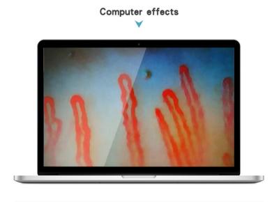 中国 毛管Microcirculationの380回にわたる医学の顕微鏡の拡大 販売のため