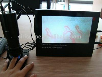 Cina Dispositivo capillare del microscopio di microcircolazione del Nailfold LCD accurato di colore per il sotto controllo di salute in vendita