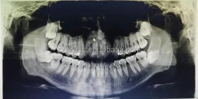 Κίνα Οδοντιατρική ΤΠ 3D CBCT Ψηφιακό εξοπλισμό ακτινογραφίας προς πώληση