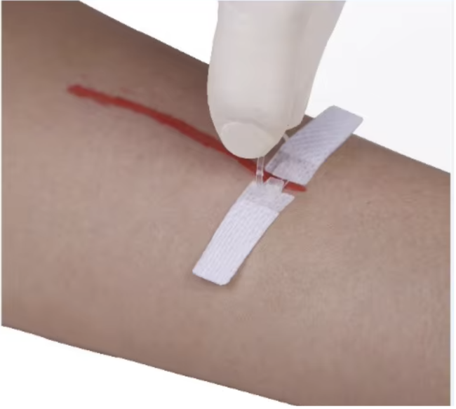 Self-Adhesive Dermaclip wound closure device - side view