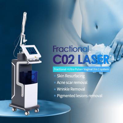 China CO2-fractionele lasermachine De meest geavanceerde oplossing voor littekenverwijdering Te koop