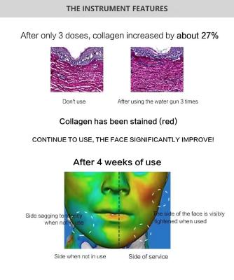 China Máquina portátil de aguja micro de alta calidad Rf, indolora y suave Morpheus 8 Máquina fraccionada para el levantamiento facial en venta