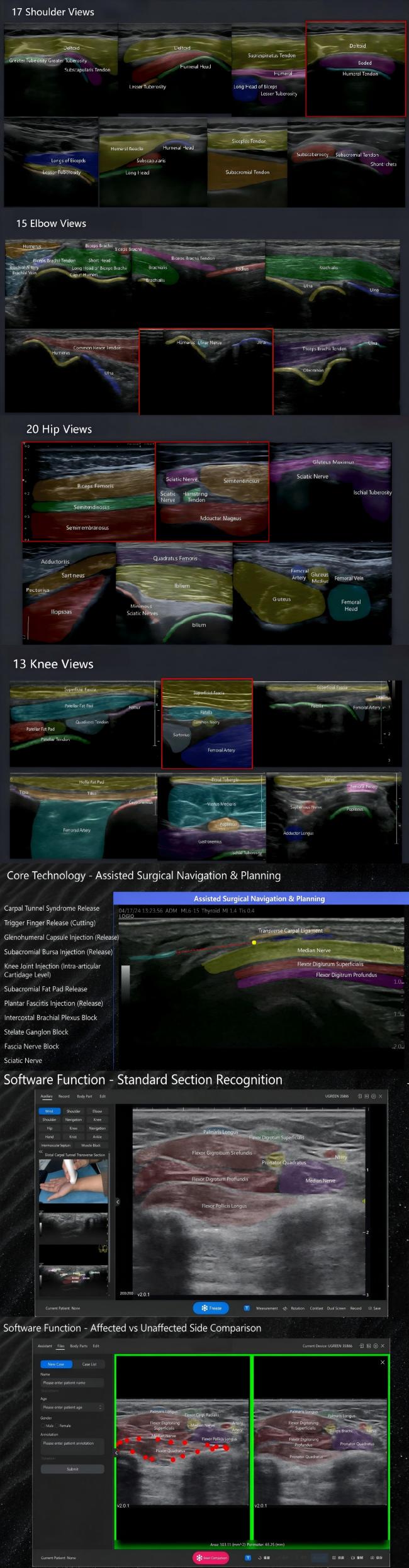AI_ultrasound_software_interface