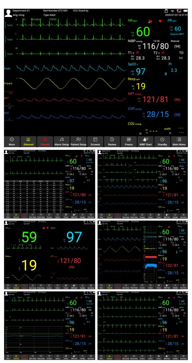 patient monitor interface_detail