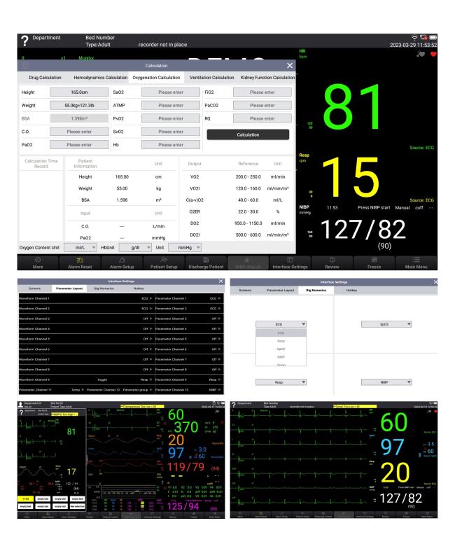 Patient monitor_A20 interfaces