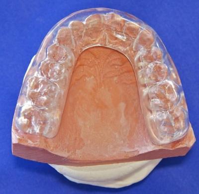 Semi Hard Soft Occlusal Mouth Guard Dental Comfortable FDA Certified