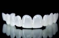 Quality Removable Snap On Veneers Snow White Shade Good Fit Dental Design Service for sale