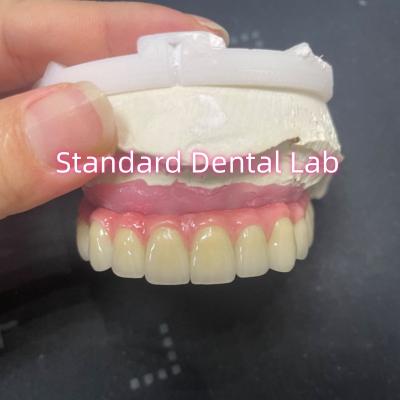 Chine Le pont Malo Hybride Zirconia Tout sur quatre / six Zirconia Implant Bridge Bar Titanium à vendre
